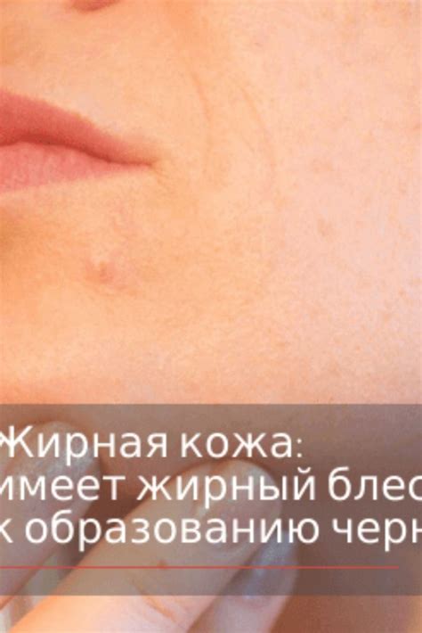 Жирная кожа лица -как правильно ухаживать? | Кожа, Жирная кожа, Лицо