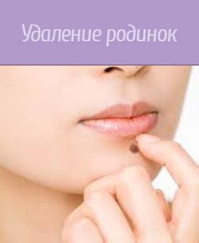 Удаление родинок лазером в Самаре - цены от 700 р