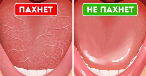 Как избавиться от запаха изо рта / Бери и делай