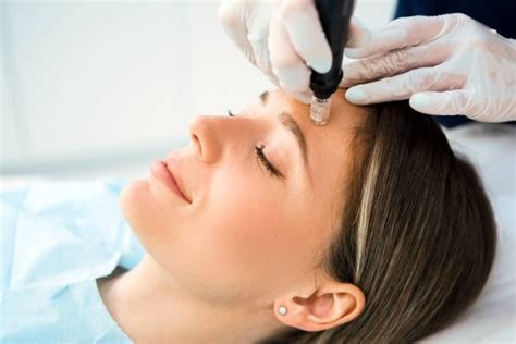 Dermaroller Nedir Nasıl Kullanılır? - Laya Hair Blogu