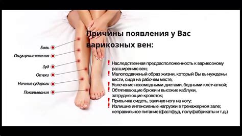 Состав монастырского чая от варикоза! - YouTube