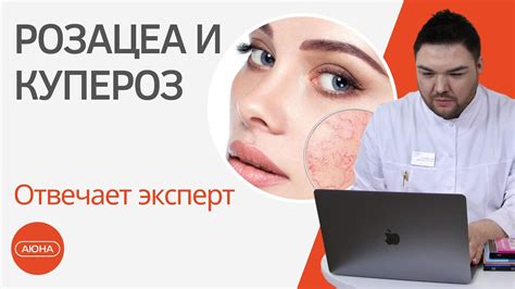 Розацеа и купероз: отвечает эксперт - YouTube