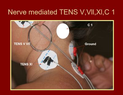 The Relationship between the Dental Occlusion, Upper Cervical spine and ...