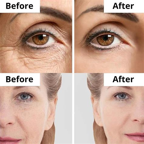 Anti-Aging Cream with Argireline & Stem Cells | DermaSet