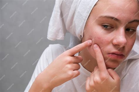 Premium Photo | Acne a teenage girl squeezing out a pimples on her face in front of a mirror ...