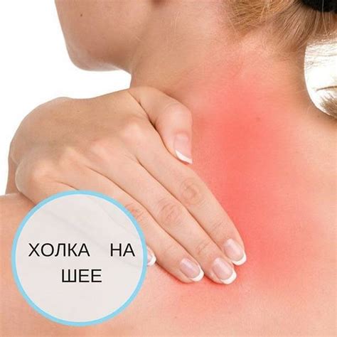 Как избавиться от холки на шее? » женский мир