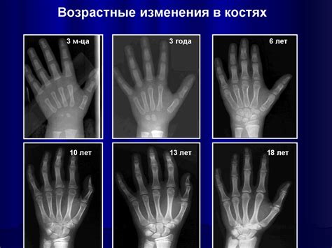 Лучевая диагностика костно-суставной системы - презентация онлайн