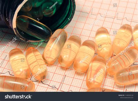 Electrocardiogram Graph Ekg Heart Rhythm Tablets Stock Photo 1149350120 ...