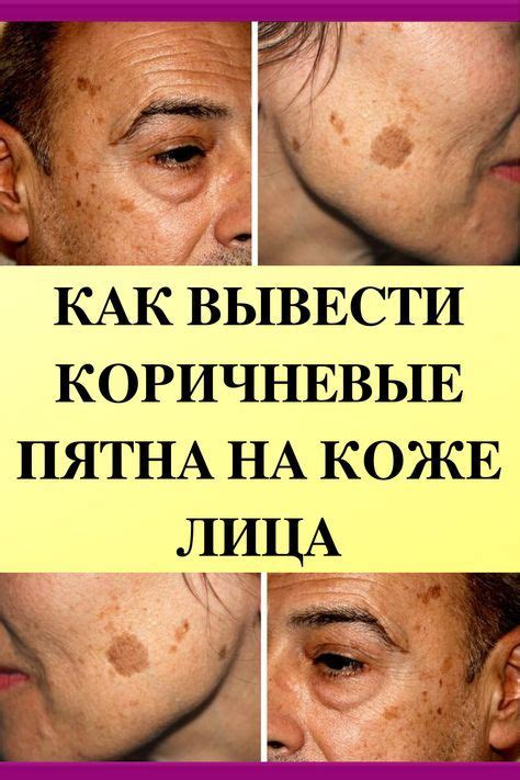 Копеечное лекарство, которое решит все ваши проблемы с кожей ...