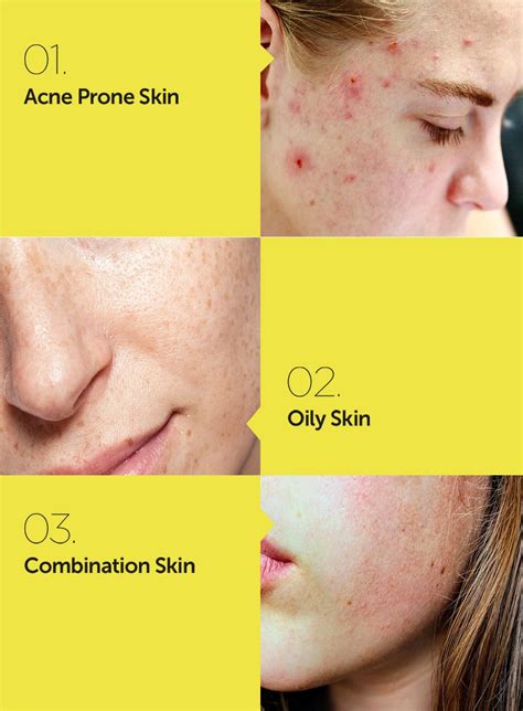 Sulfur 3% Clean Gel (30g) - By Wishtrend | K-BEAUTY – LEWKIN - AUSTRALIA