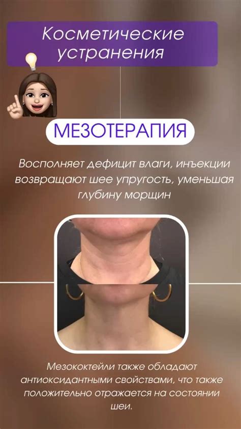 Кольца Венеры. Идеи для сторис. Косметология. Шея. Смм | Ботокс губы ...