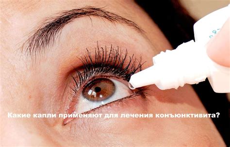 Конъюнктивит: капли для лечения, как правильно подобрать