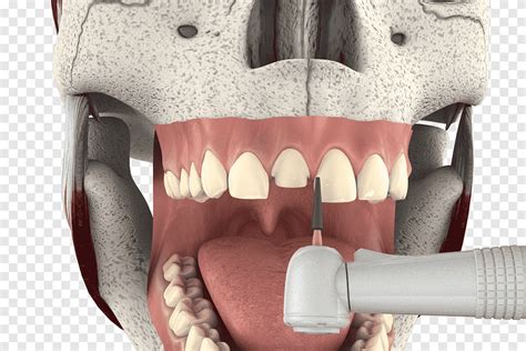 Tooth Veneer Cosmetic dentistry Mouth Jaw, 3d tooth, aesthetics, color ...