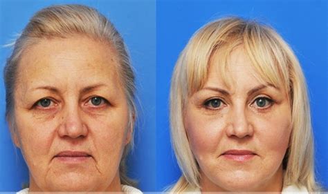 Кокосовое масло для лица: применение, польза, отзывы, как использовать ...