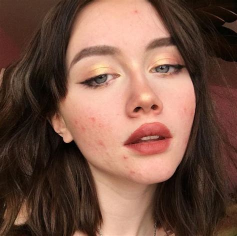 Acne Fighter And Daily Skincare