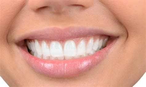 Bei denti immagine stock. Immagine di salute, dentale - 31490877