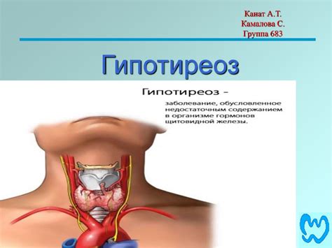 Гипотиреоз. Анатомия щитовидной железы - презентация онлайн