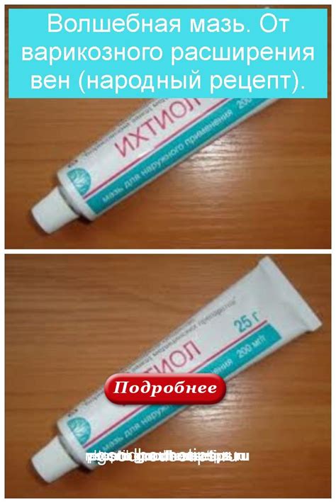 Волшебная мазь. От варикозного расширения вен (народный рецепт).