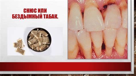 Снюс. Табак бездымный, но не безвредный - презентация онлайн