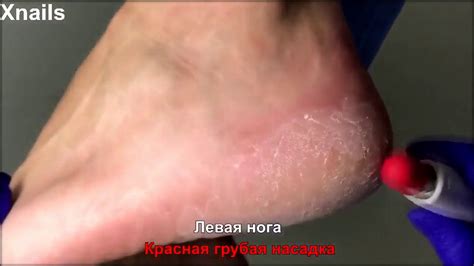МУЛЬТИБОР -фрезы для педикюра - YouTube
