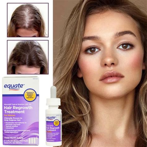 Комплект срещу косопад при жени, Minoxidil Equate 2%, приложение за 2 ...