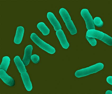 Lactobacillus acidophilus: Ein Probiotikum für´s Wohlbefinden