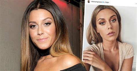 Bianca Ingrosso bryter tystnaden om skönhetsingreppet | Hänt