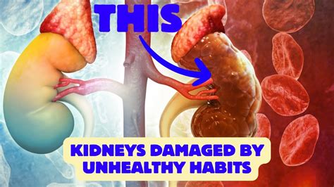 Stop These Habits at 50! Protect Your Kidneys Before It's Too Late - YouTube