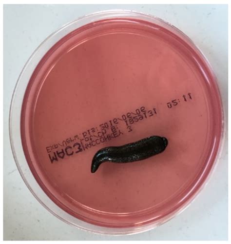 Lethal Aeromonas veronii Sepsis in the Course of Medicinal Leech Therapy