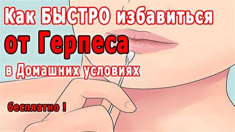 Как Вылечить Герпес на Губах в Домашних Условиях Быстро 👍 Как ...