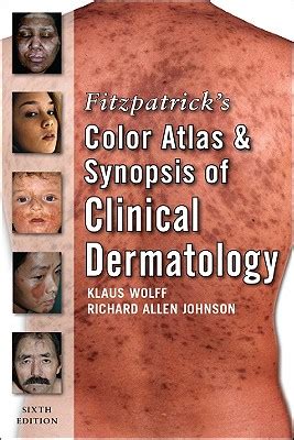 All about Medicine: Fitzpatrick's Color Atlas and Synopsis of Clinical ...