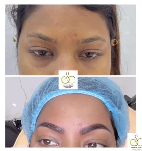 Dr. Shagun Gupta on LinkedIn: #correctionbrowsindia #permanenteyebrows #browembroideryindia…