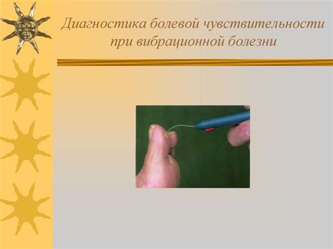 Вибрационная болезнь (0) - online presentation
