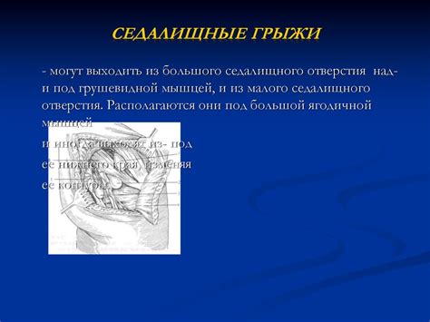 Грыжи живота - презентация онлайн