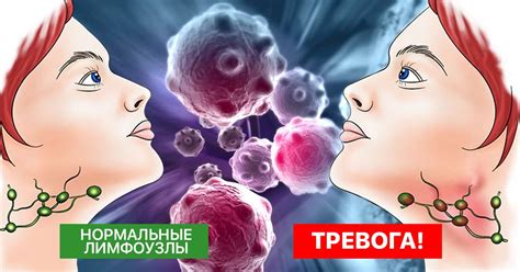 Очищение лимфы - Со Вкусом