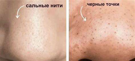 Как убрать черные точки на носу в бане - 80 фото