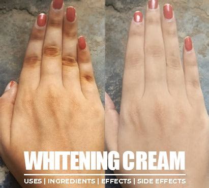 Whitening Cream - Best Skin Whitening Cream in Pakistan | The Skin Lab