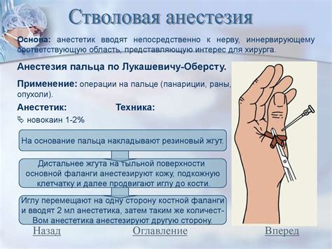 Местная анестезия - презентация онлайн