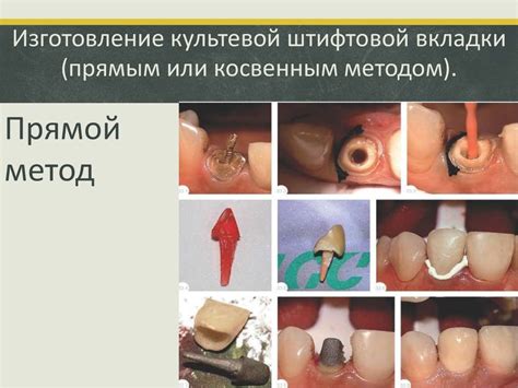 Лечение при полном отсутствии коронки зуба штифтовыми конструкциями ...