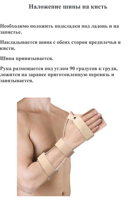 Правила наложения жгута