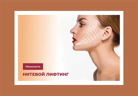 Мезонити для подтяжки лица - эффект после процедуры