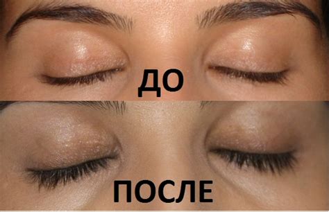 Careprost СпБ по 500р. Вся правда о Карепросте: Как привести в порядок ...