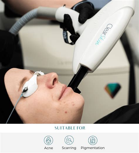 ClearSkin Treatment at Perfect Skin Solutions