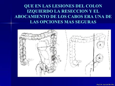 TRAUMATISMOS DEL COLON RECTO Y ANO - Prof. Dr. Luis del Rio Diez