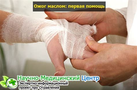 Что делать при ожоге — Первая помощь и методы лечения, степень ожогов ...