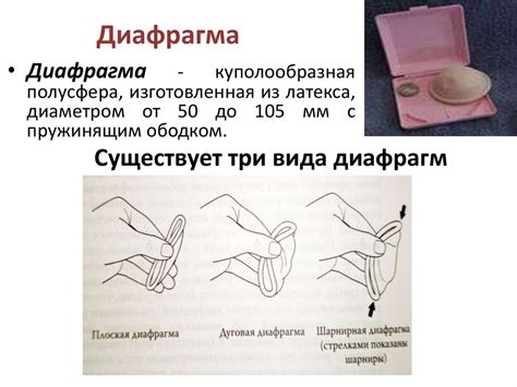 Контрацепция. Методы контрацепции - презентация онлайн
