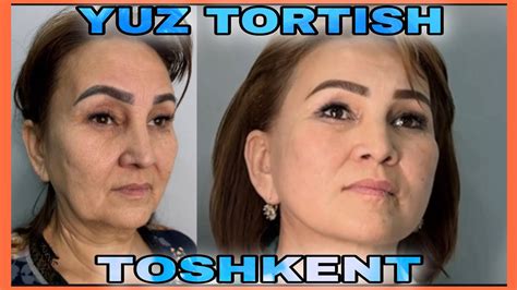ПОДТЯЖКА ЛИЦА | ЮЗ ТОРТИШ | YUZ TORTISH - YouTube
