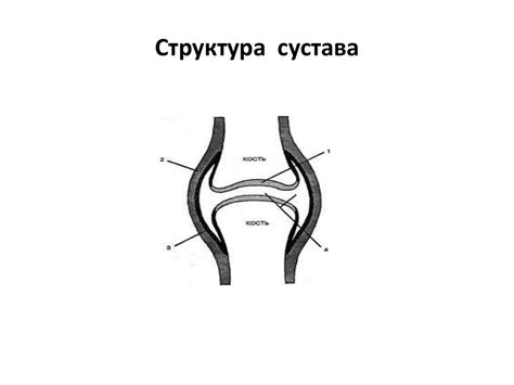 Суставной синдром - презентация онлайн