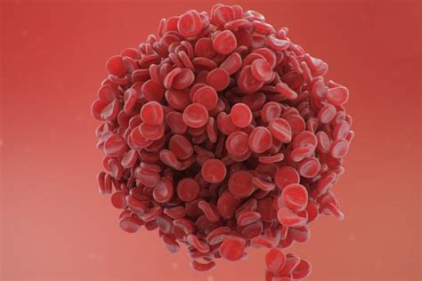 Профилактика образования тромбов: основные принципы | MedAboutMe