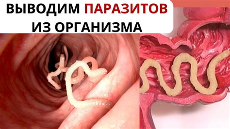 Главные враги ПАРАЗИТОВ! Эти продукты изгонят глисты - YouTube